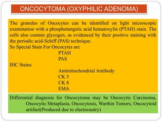 Oncocyte in salivary gland.pptx