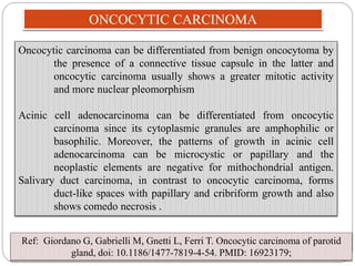 Oncocyte in salivary gland.pptx
