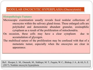 Oncocyte in salivary gland.pptx