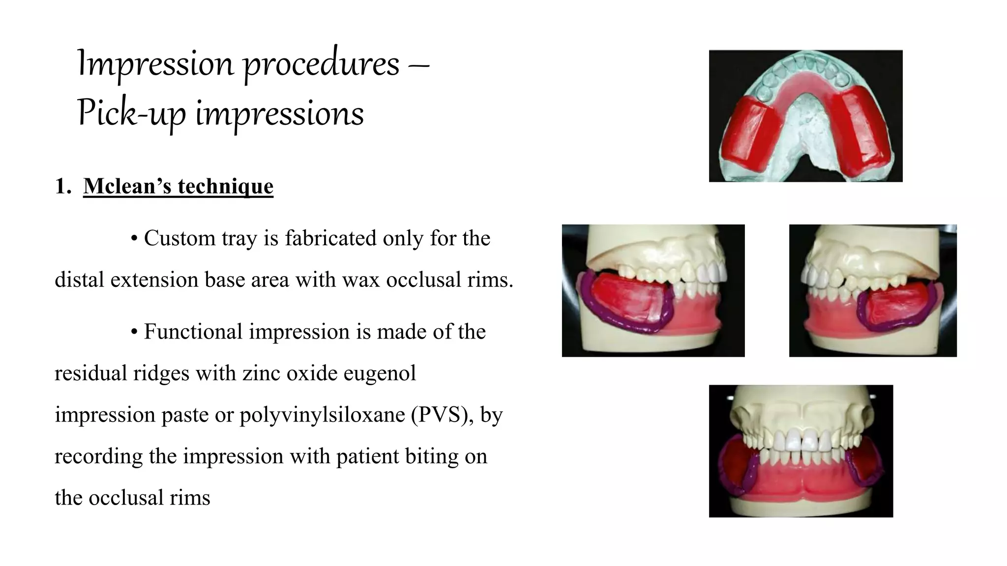 Impression techniques in RPD.pptx