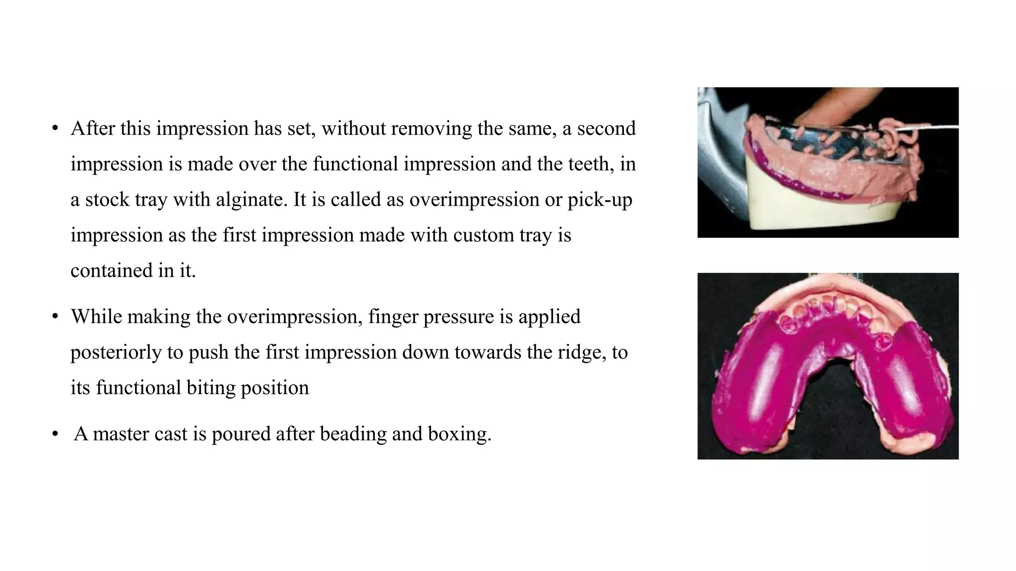 Impression techniques in RPD.pptx