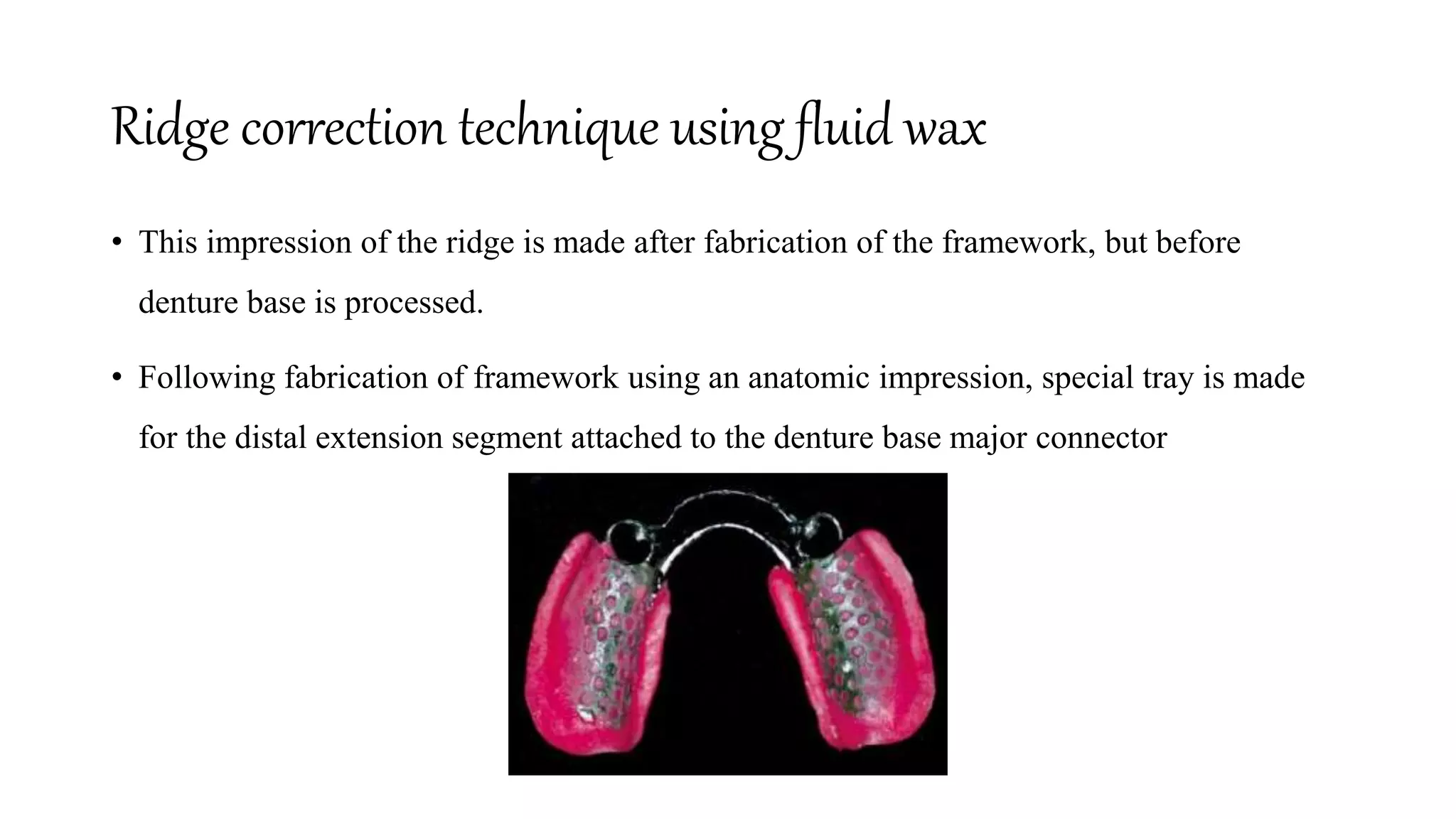 Impression techniques in RPD.pptx