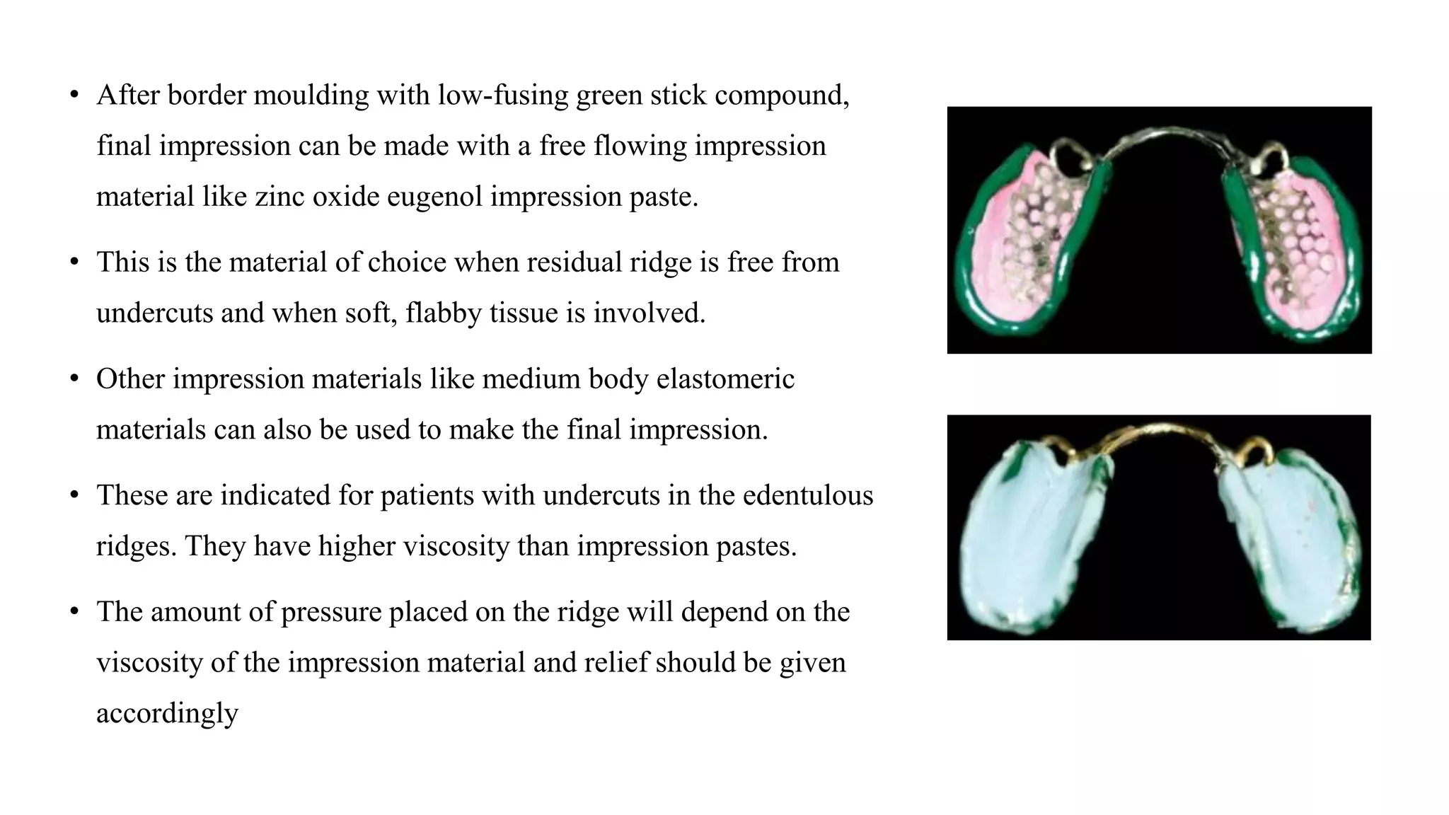 Impression techniques in RPD.pptx