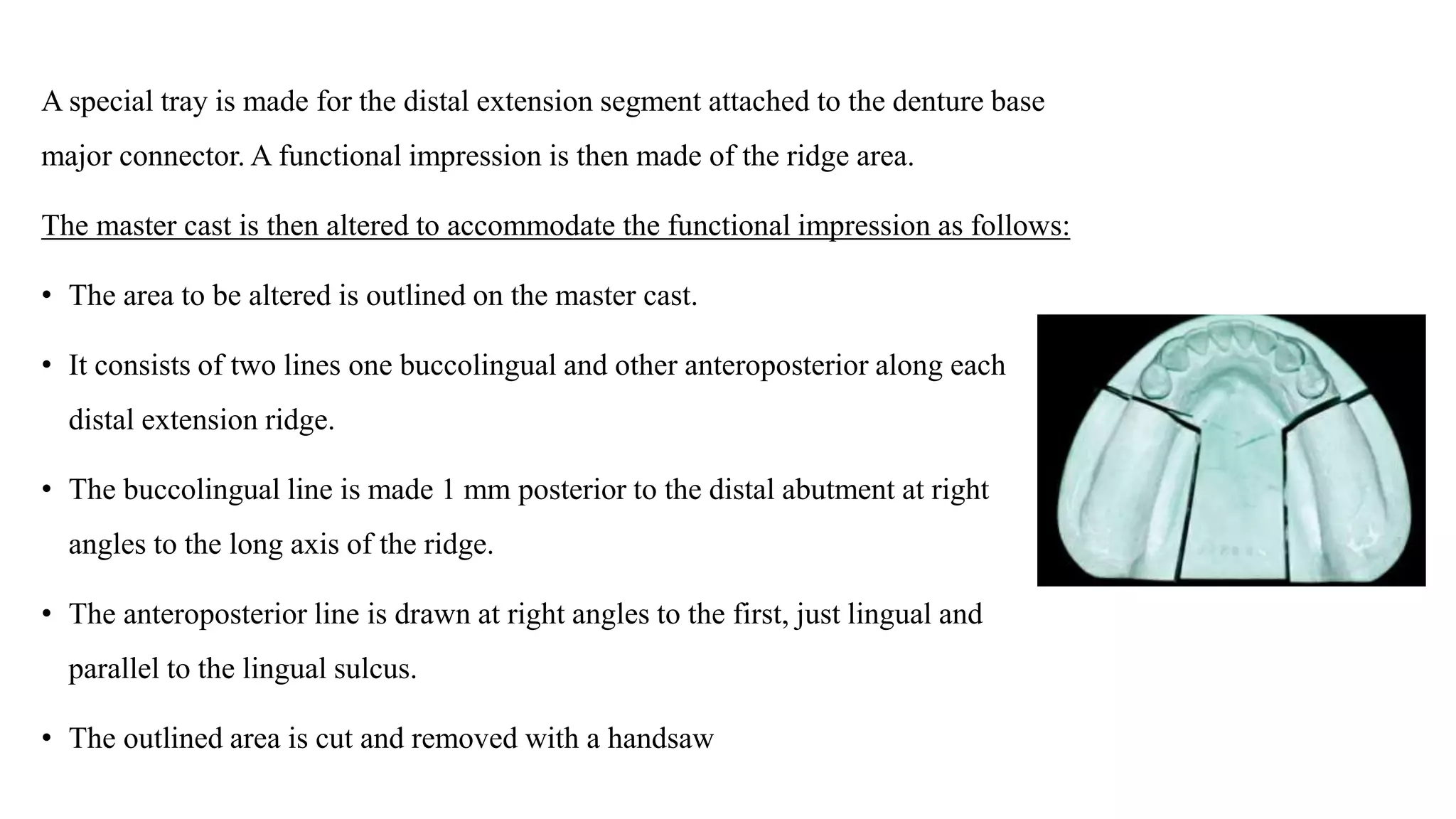 Impression techniques in RPD.pptx