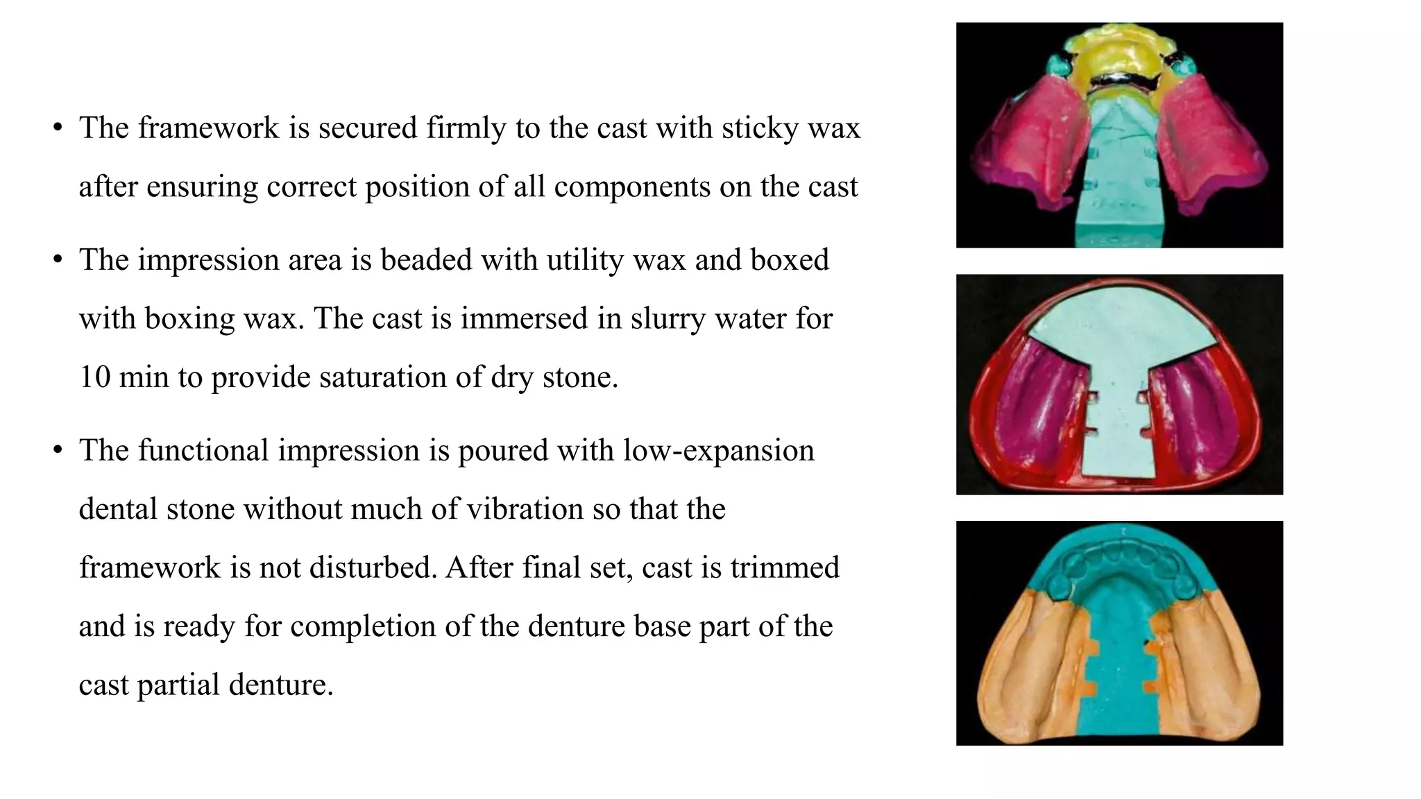 Impression techniques in RPD.pptx