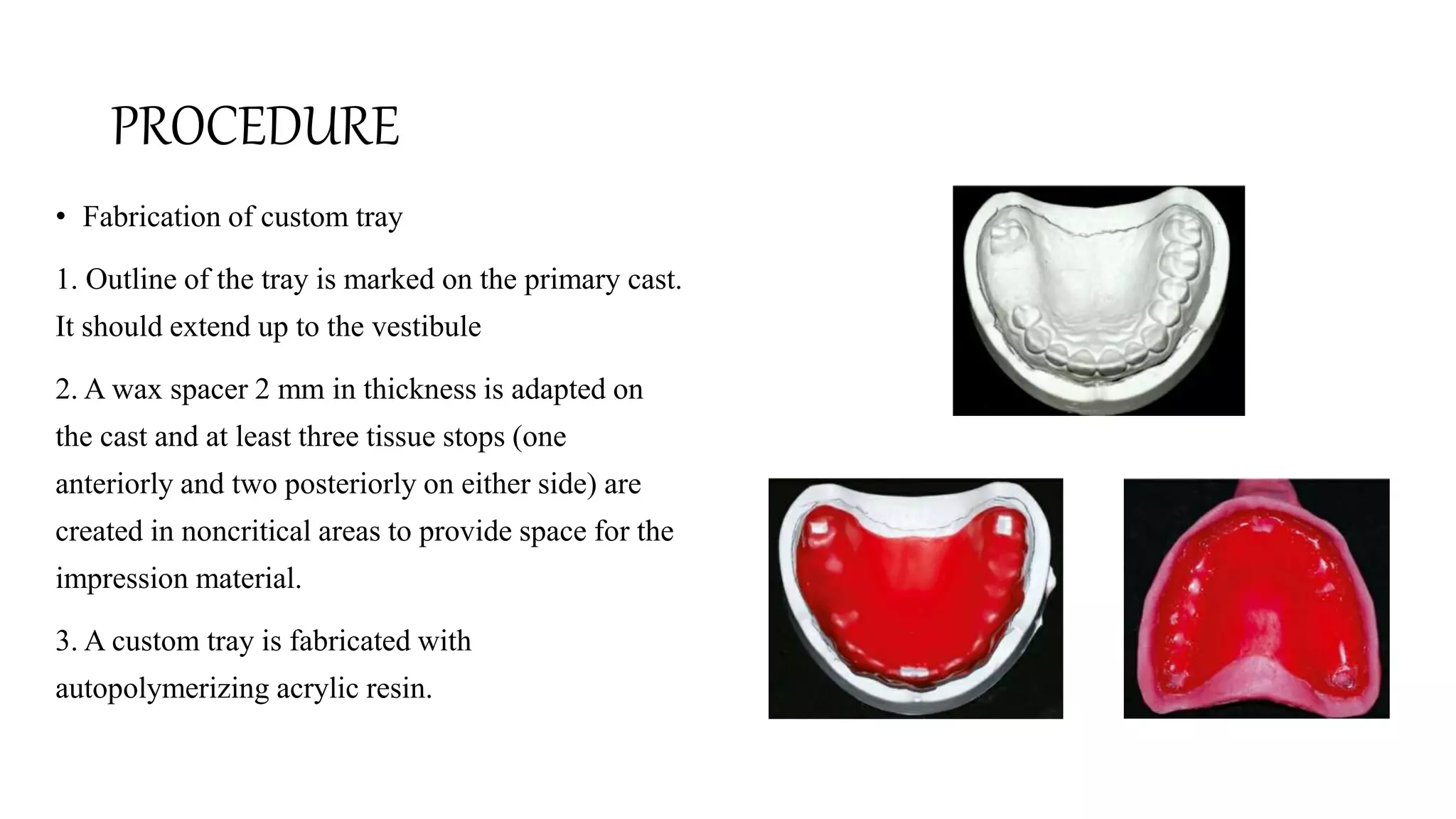 Impression techniques in RPD.pptx