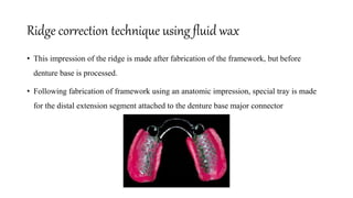 Impression techniques in RPD.pptx