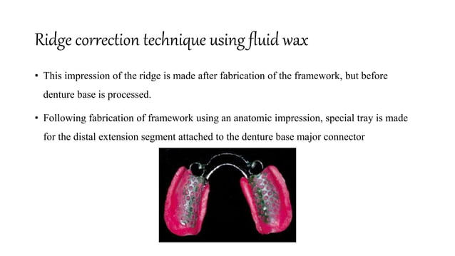 Impression techniques in RPD.pptx