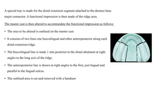 Impression techniques in RPD.pptx