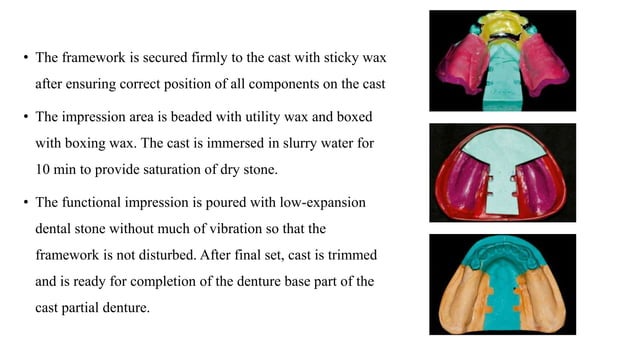 Impression techniques in RPD.pptx