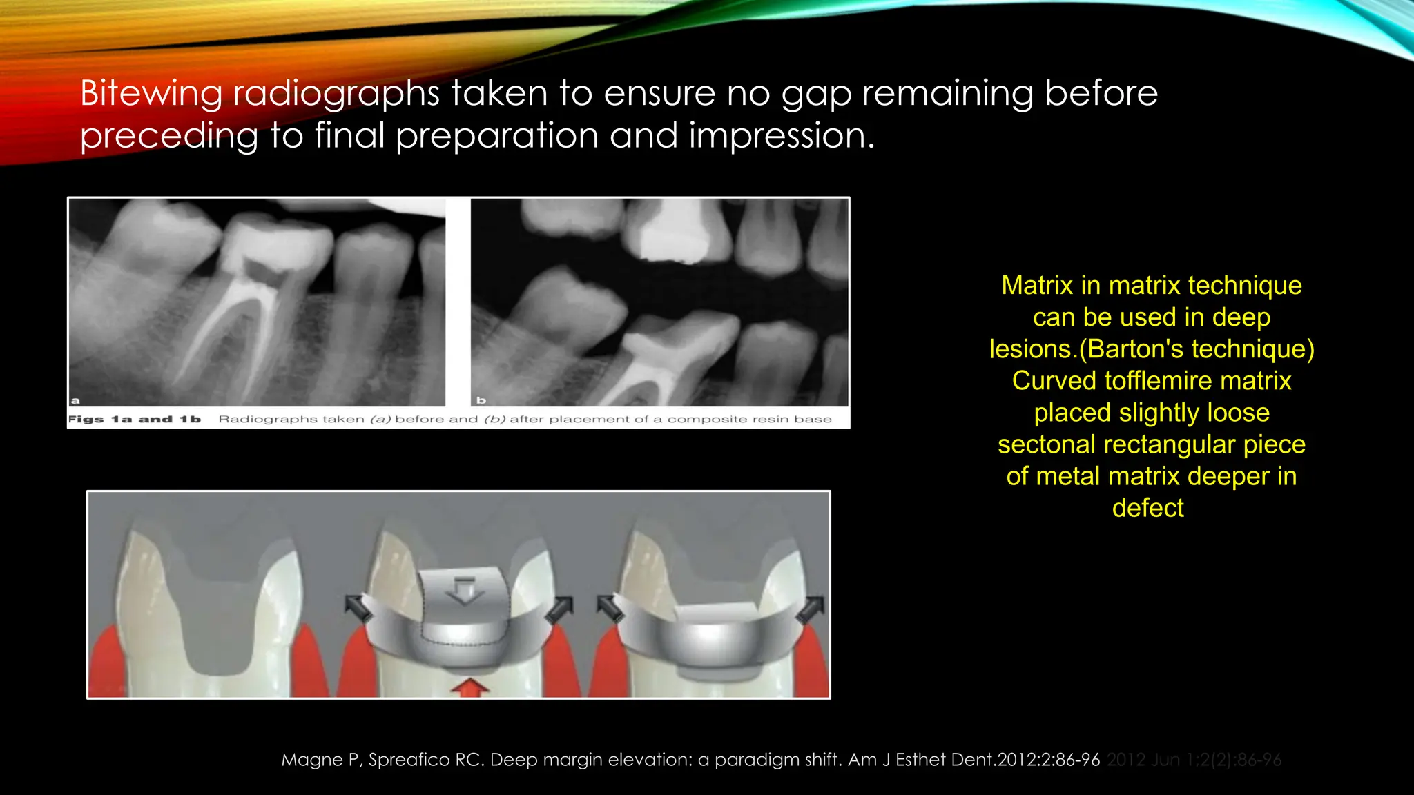 PEDAGOGY on DEEP MARGIN ELEVATION. Cons and endo pptx | PPTX