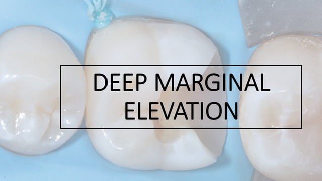 PEDAGOGY on DEEP MARGIN ELEVATION. Cons and endo pptx | PPTX