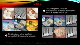PEDAGOGY on DEEP MARGIN ELEVATION. Cons and endo pptx | PPTX