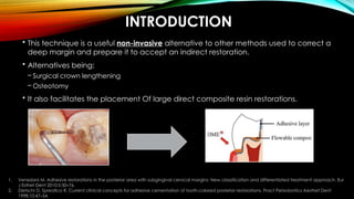 PEDAGOGY on DEEP MARGIN ELEVATION. Cons and endo pptx | PPTX