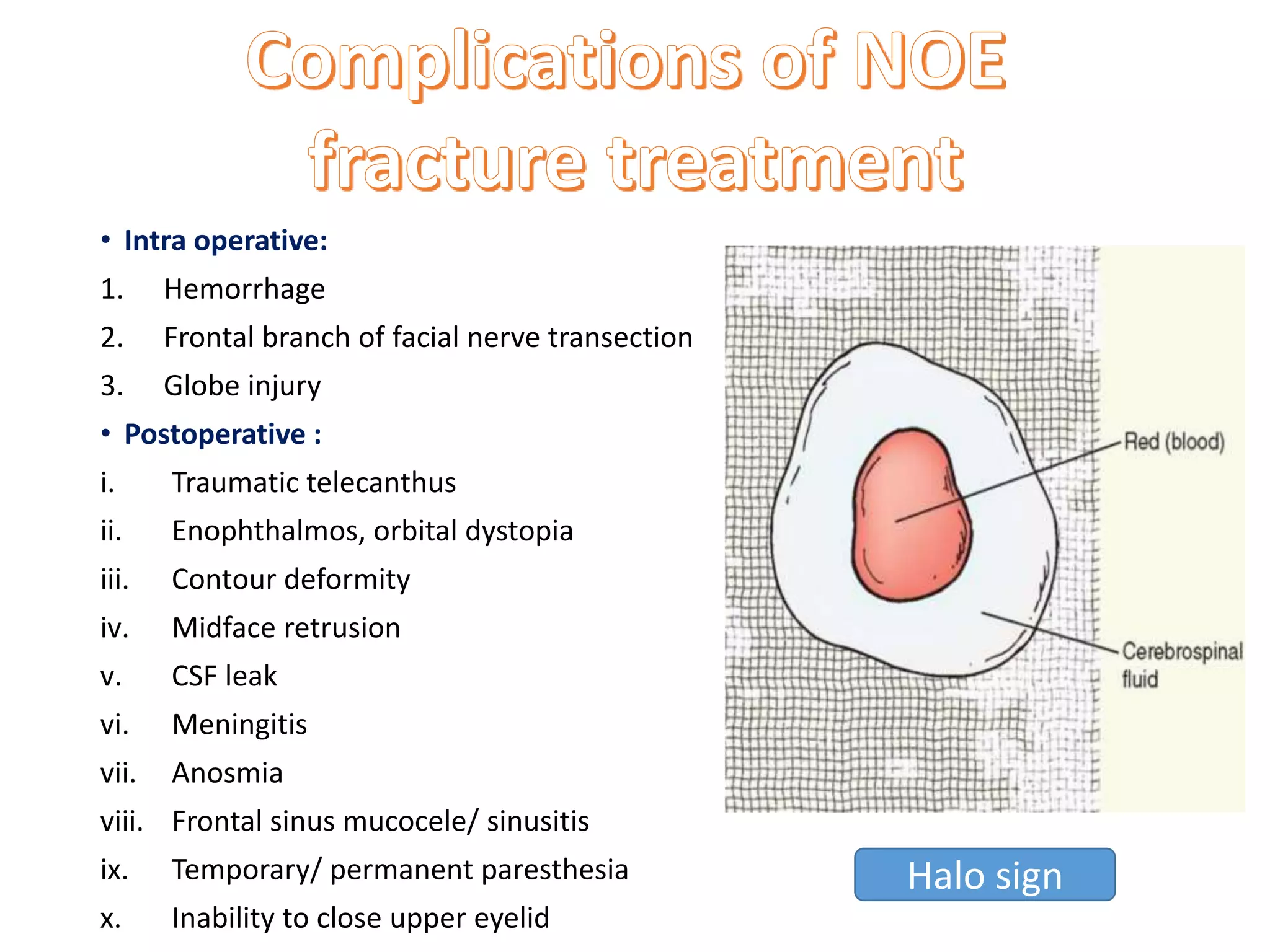 Naso-orbital-ethmoid (NOE) fractures: Management principles, options ...