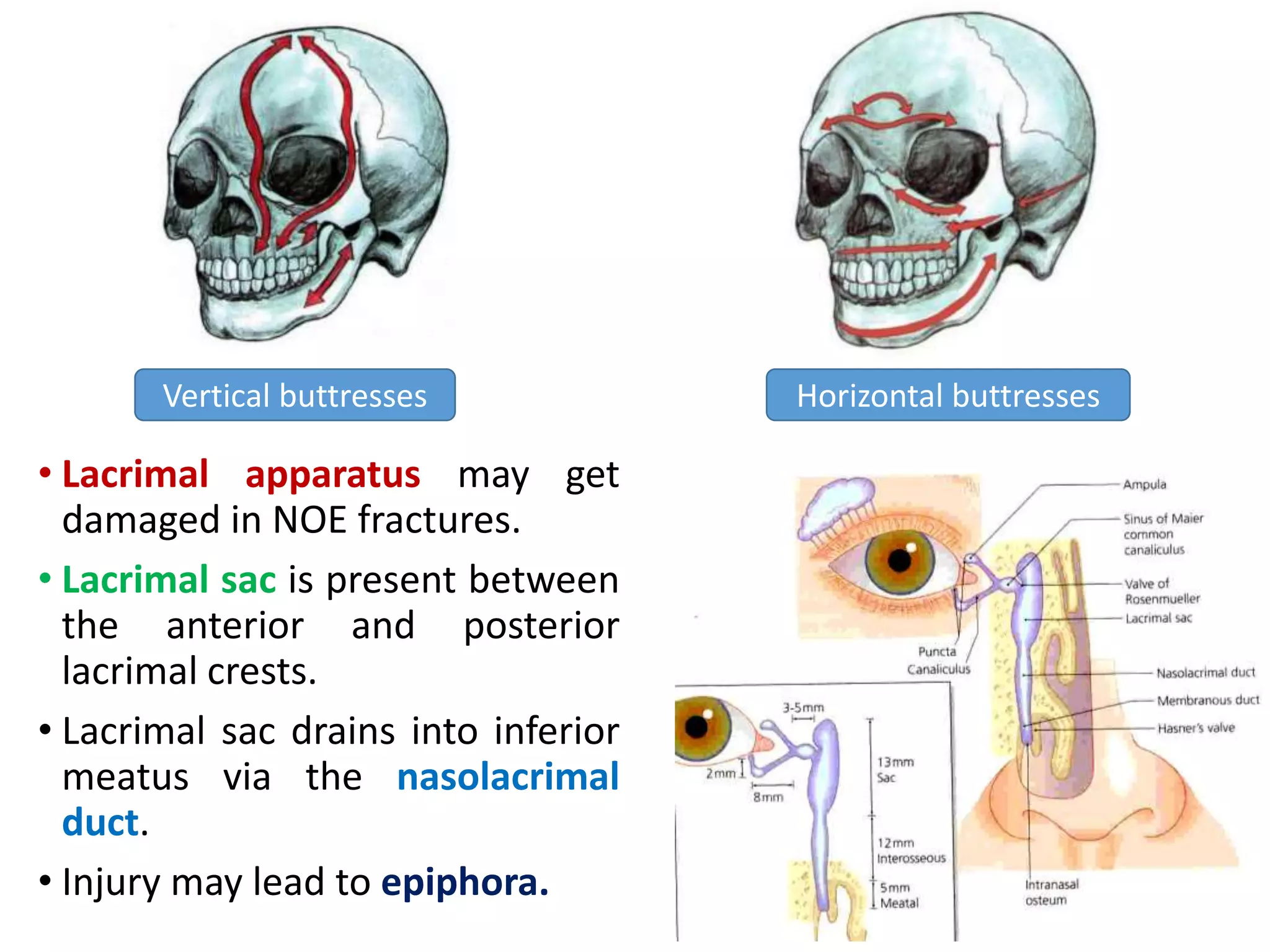 Naso-orbital-ethmoid (NOE) fractures: Management principles, options ...