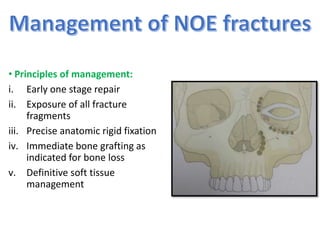 Naso-orbital-ethmoid (NOE) fractures: Management principles, options ...