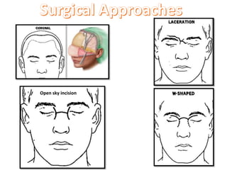 Naso-orbital-ethmoid (NOE) fractures: Management principles, options ...