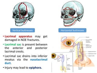 Naso-orbital-ethmoid (NOE) fractures: Management principles, options ...