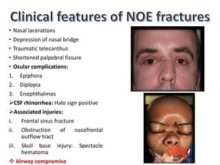 Naso-orbital-ethmoid (NOE) fractures: Management principles, options ...
