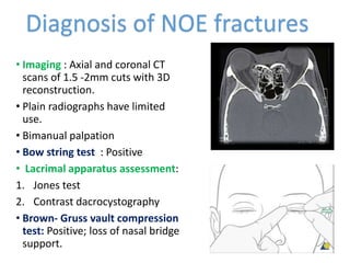 Naso-orbital-ethmoid (NOE) fractures: Management principles, options ...