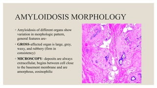 AMYLOIDOSIS | PPT