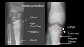 structure of physis | PPTX