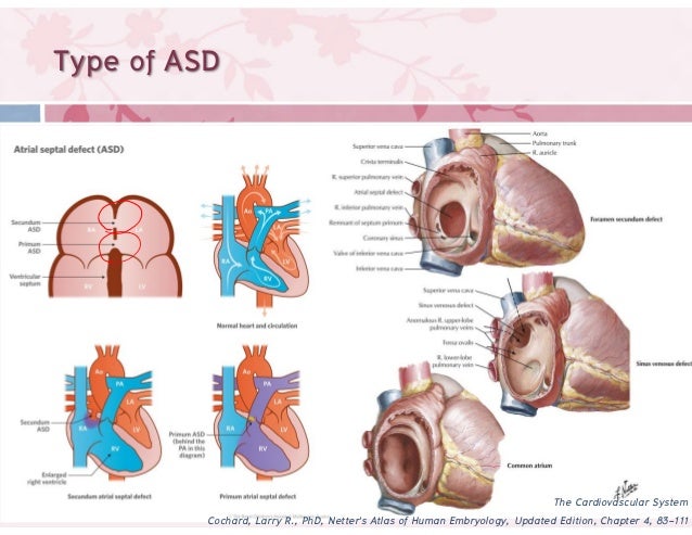 Congenital Heart Disease