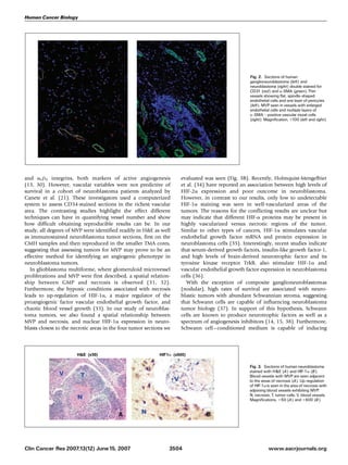 Peddinti, Zeine et al. Clinical Cancer Research 2007 | PDF | Blood Disorders | Diseases and ...