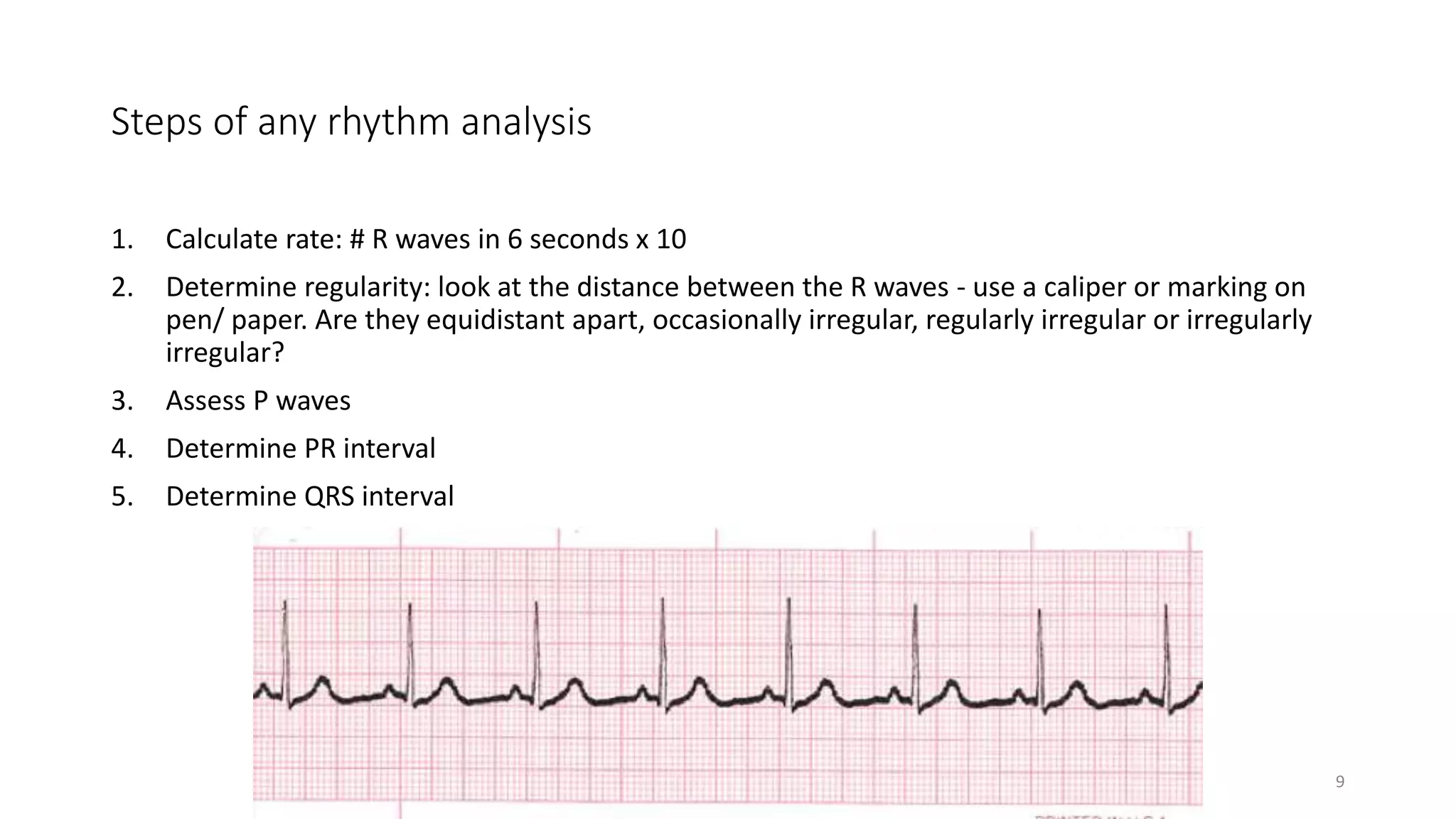 Pediatric ECG Notes | PPTX