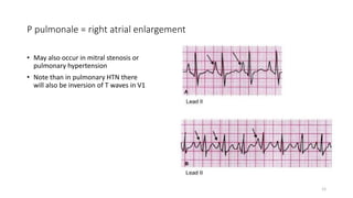 Pediatric ECG Notes | PPTX