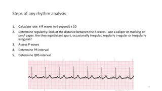 Pediatric ECG Notes | PPTX
