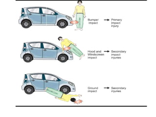 Pedestrian injuries in road traffic accidents | PPT