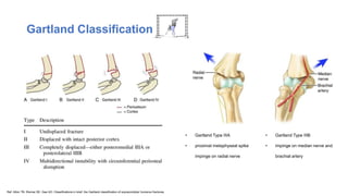 pediatric fracture around elbow.pptx