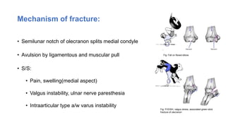 pediatric fracture around elbow.pptx