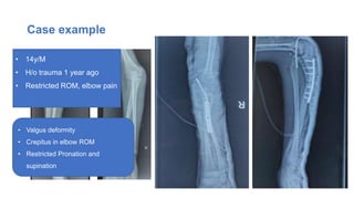 pediatric fracture around elbow.pptx