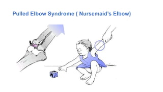 pediatric fracture around elbow.pptx