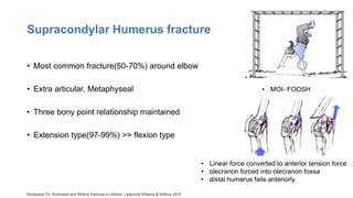 pediatric fracture around elbow.pptx