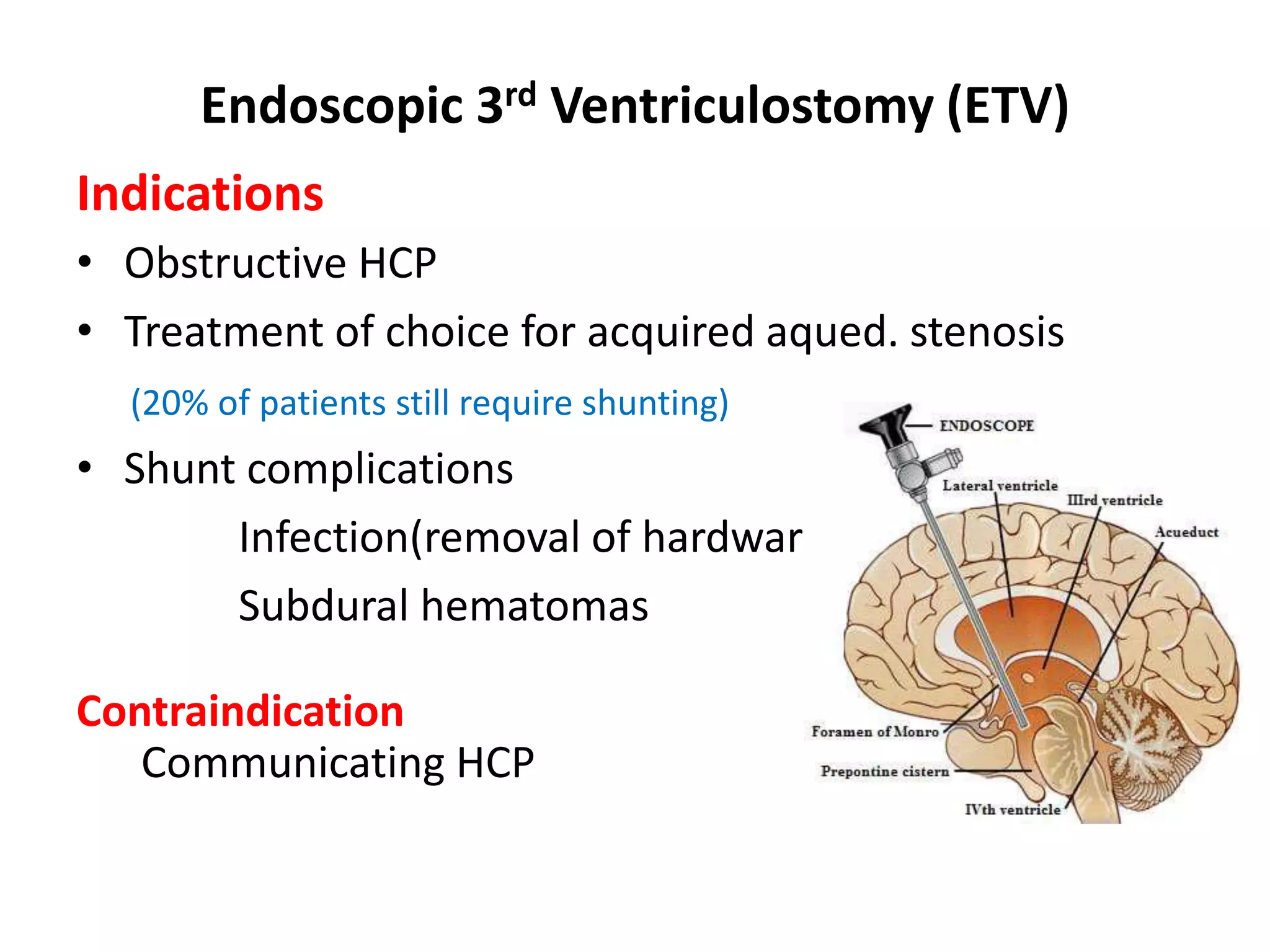 Pediatric Hydrocephalus | PDF