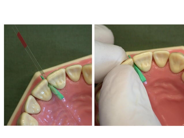 Pedia class III | PDF | Dental Health | Diseases and Conditions