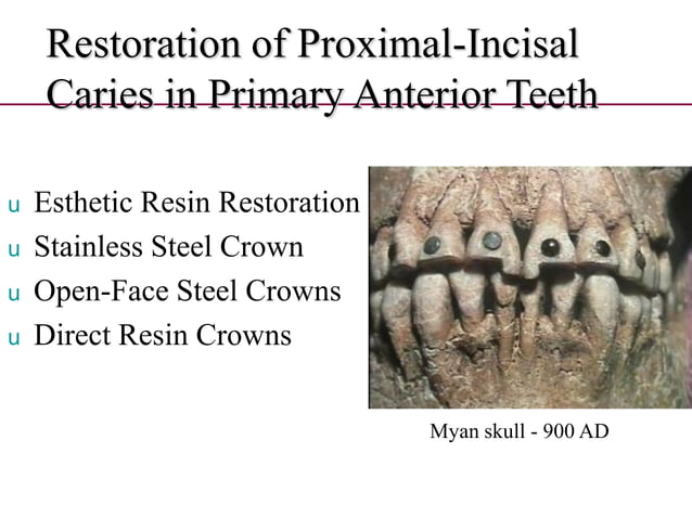 Pedia class III | PDF | Dental Health | Diseases and Conditions