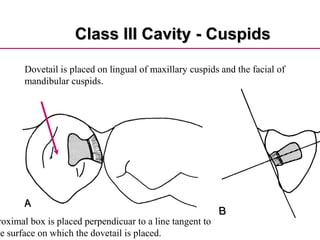 Pedia class III pre | PDF