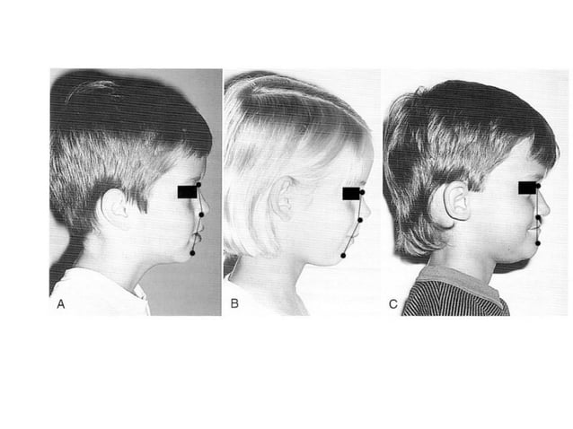 Pedia clinical examination and diagnosis | PDF | Ear, Nose and Throat ...