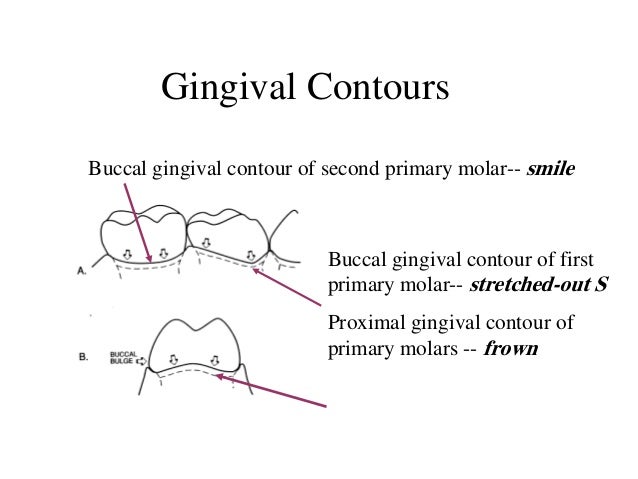 Pedia stainless steel crown