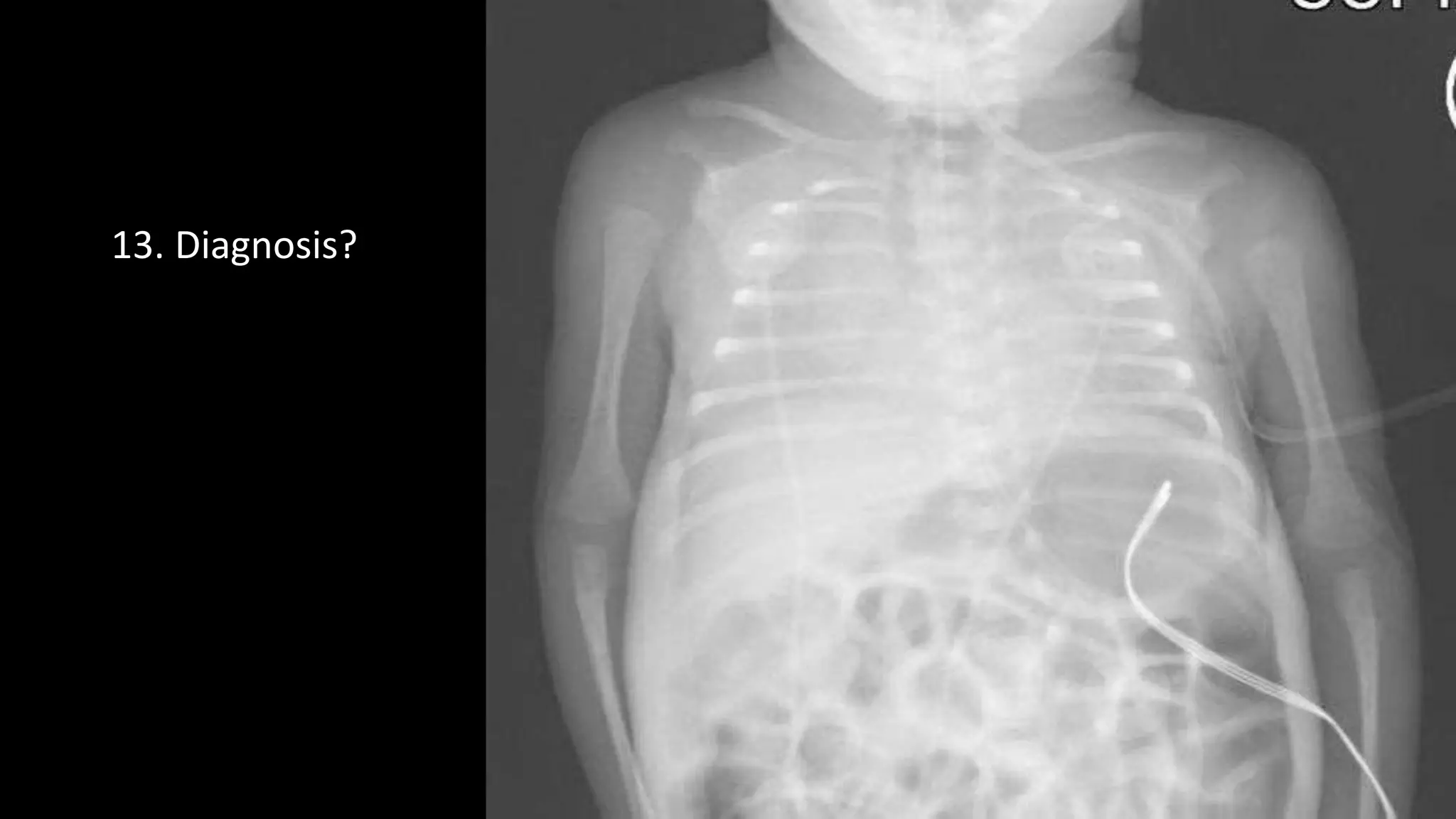 Radiology - Practical Exam for Basic Pediatric and GIT imaging.pptx