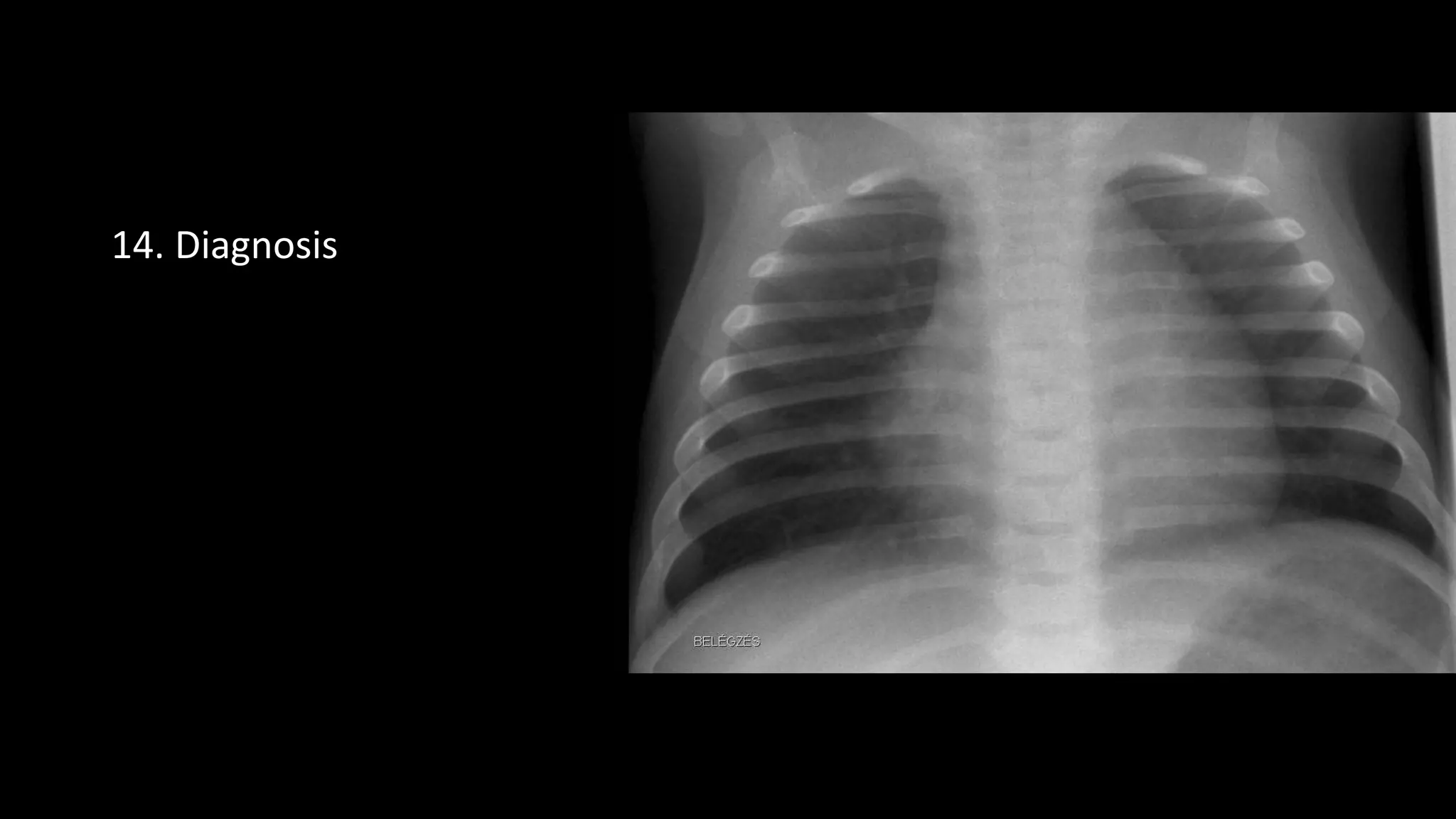 Radiology - Practical Exam for Basic Pediatric and GIT imaging.pptx