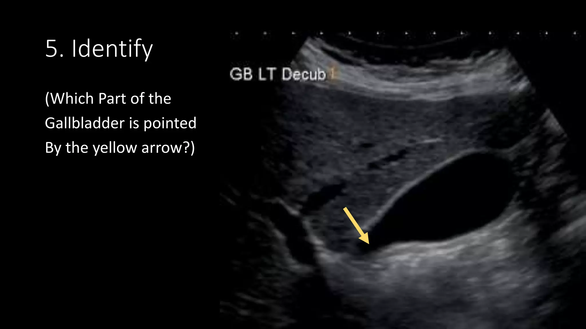 Radiology - Practical Exam for Basic Pediatric and GIT imaging.pptx
