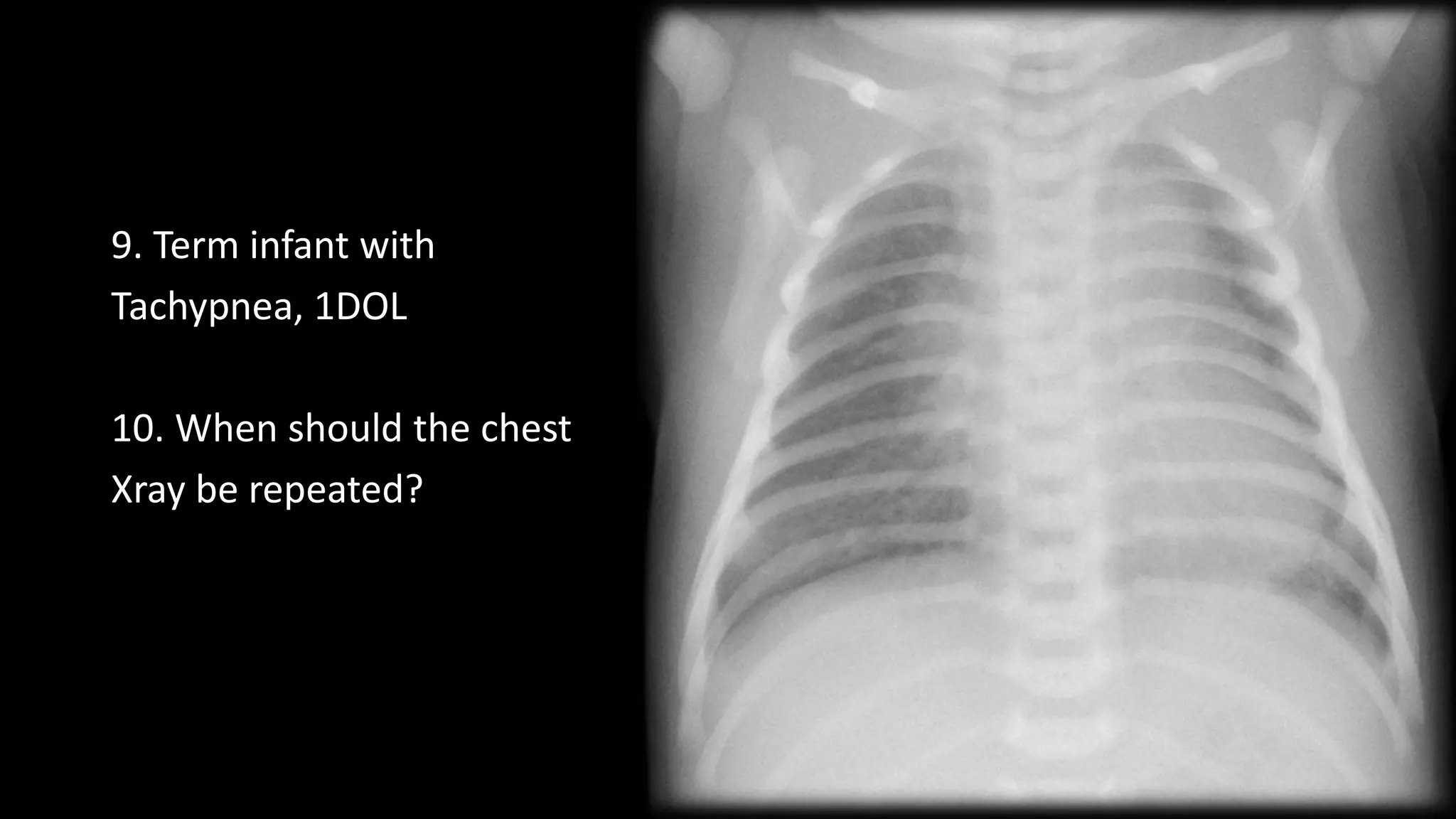 Radiology - Practical Exam for Basic Pediatric and GIT imaging.pptx