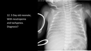 Radiology - Practical Exam for Basic Pediatric and GIT imaging.pptx
