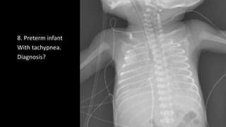 Radiology - Practical Exam for Basic Pediatric and GIT imaging.pptx